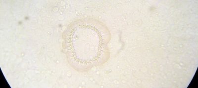 Koi Disease Diagnosis and Treatment - Hydrosphere